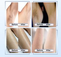 China CE ISO Approved High Power 600-3500W Diode Laser Hair Removal Beauty Salon Equipment for sale