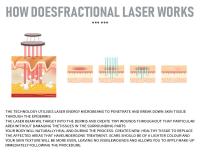 China 30W CO2 Fractional Laser Machine for Vaginal Treatment and Scar Removal in Multi-language for sale