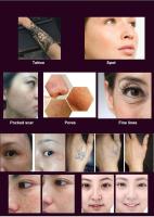 China 2024 Professional Picosecond Pico Laser 755Nm Tattoo Removal Machine Nd Yag Laser PicoLaser for sale