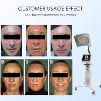 China 300pcs LED Red Skin Treatment PDT Therapy Machine with STANDING Feature and 7 Colors for sale
