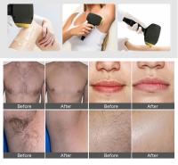 China Picosecond 2024 Painless Ice Cool Permanent Diode 808 Hair Removal Laser Tattoo Beauty Machine QSwitch Nd YAG Micro Carbon Skin for sale