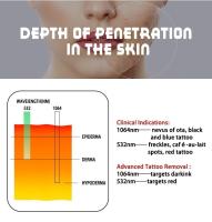 China Cooling System Closed-Off Water Circulation AI Pico Second Laser Tattoo Removal Machine for sale