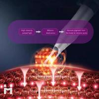 China Advanced Pico Laser Technology for Fast and Effective Tattoo Removal at 1064nm 532nm for sale