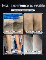 China 2024 Europe High Power 808 Diode Laser Hair Removal Machine with Germany Laser Bar for sale