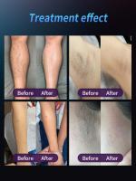 China 1060nm Diode Laser Hair Removal Machine with 15.6 Inch True Color LCD Touch Screen for sale