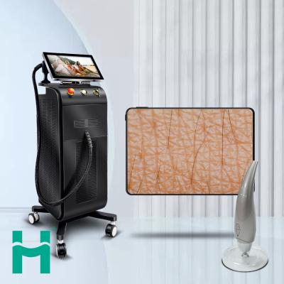 China Effortless Hair Removal Huamei 510K Diodo 808NM Diode Laser with 755 808 1064 Handles for sale
