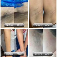 China Diode Laser Hair Remover for Smart Interconnection of Mobile Phones and Machines for sale