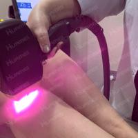 China Advanced 755nm 808nm 1064nm Wavelength Diode Laser Hair Removal Machine for Medical for sale