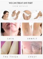 China Software OEM 808nm Diode Laser Hair Removal Machine with High Power 3 Wavelength Laser Bar for sale