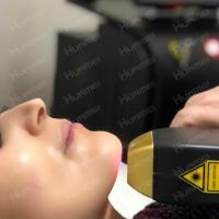 China 4K Display 1200W 1600W Laser Hair Removal 940nm 4 Wavelength Diode Ice Diode Titanium Diode Laser for sale
