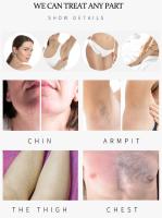 China Permanently Remove Hair with 808nm Diode Laser Hair Removal Machine CE TUV Approved for sale
