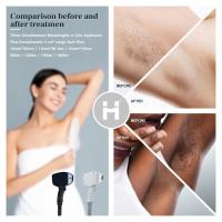 China TUV Medical CE 755 808 1064nm Ice Platinum Hair Removal Lightsheer Diode Laser Machine for sale