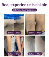 China Switchable Spot 808nm Diode Laser Hair Removal Machine for OEM/ODM Aesthetic Medicine for sale