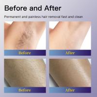 China NO Q-Switch HUAMEI 808 Diode Laser Hair Removal Machine for and Comfortable Treatment for sale