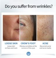 China 12d Face Lift Skin Tightening Wrinkle Removal Machine with 1470nm Diode Laser Therapy for sale