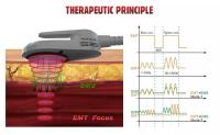 China EMS Circslim Technology Non-invasive Body Shaping for Weight Loss and Muscle Building for sale