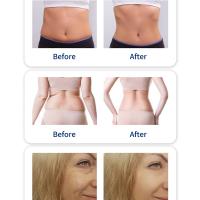 China V8 Face Lifting Wrinkle Removal Cellulite Reduce Vacuum RF Roller Firming Massage Slimming Machine for sale