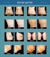 China Safe Body Weight Loss with Beautemax Laser Shape 1060nm Diode Laser in STANDING Mode for sale