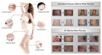 China 4 in 1 Multifunctional Body Slimming Shaping Fat Loss Device HM with Cooling System for sale