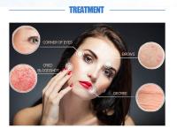 China High Pressure Hydra Peeling Hydrotherapy Machines for Deep Cleansing and Rejuvenation for sale