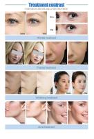 China US Plugs Oxygen Spray Multi-Function Machine for 2023 Israel Skin Care Jet Peel Device for sale