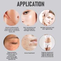China Professional CO2 Fractional Laser for Stretch Marks and Acne Scar Removal in Commercial for sale