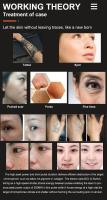 China Weifang Huamei Nd Yag Laser Tattoo Removal Beauty Machine Effective and Safe Removal for sale