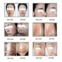 China Commercial 12 In 1 Diamond Dermabrasion Machine for Hydro Oxygen Jet Skin Rejuvenation for sale