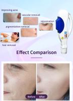 China 3in 1 IPL Laser Hair Removal Machine for Skin Rejuvenation on 15.4 Inch Touch Screen for sale