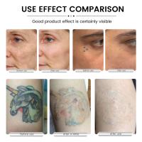 China Multifunctional RF E-light IPL Rejuvenation ND YAG Laser Tattoo Removal Diode Laser Hair Removal Machine for sale