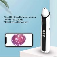 China 1080p Hd Home Beauty Equipment For All Skin Treatment Wireless Visual Blackhead Cleaner for sale