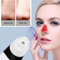 China 1080p Hd Home Beauty Equipment For All Skin Treatment Wireless Visual Blackhead Cleaner for sale