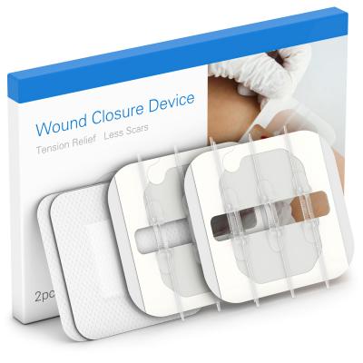 China PWT1003 Flexible Fabric Bandages Wound Closure Device 2PCS for sale