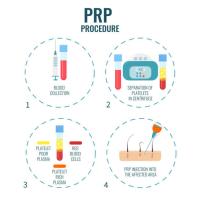 China Veterinary Medicine:** Process animal blood for PRP therapies in equine and canine sports medicine. for sale