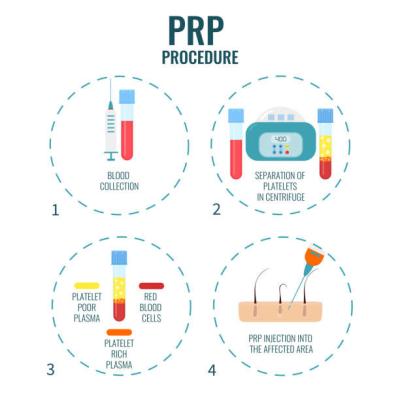 China Veterinary Medicine:** Process animal blood for PRP therapies in equine and canine sports medicine. for sale