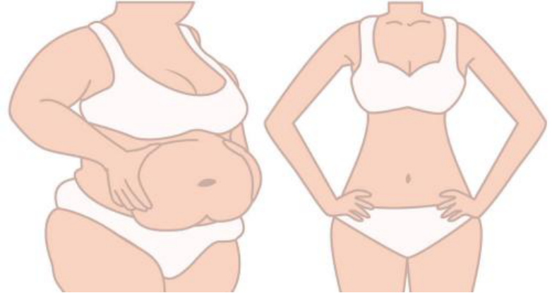 velashape machine