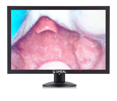 China ICU Emergency Portable Video Laryngoscope with Big LCD Monitor 3 - 60mm for sale