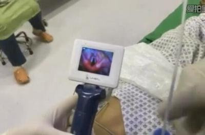 China Portable Video Laryngoscope Flexible Fiberoptic Diagnostic Mac 4 Blade Intubation for sale