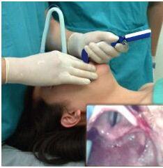 China Mac 2 Pediatric Laryngoscope Blade Size For Children Kid Airway Intubation for sale