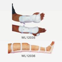 China S / M / L Hard Plastic Medical Disposable Radius Fixture Support WL12035, WL12036 for sale