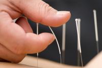 China 100pcs/Box Disposable Acupuncture Sterile Needles For Medical Acupuncture for sale