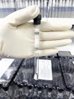 China Sterilized Vacuum Blood Collection ESR Tube Disposable Medical Products for sale