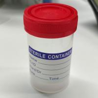 China Urine Container Sterile Sample Specimen Cup With Label 15ml-120ml Sterile Urine Container for sale