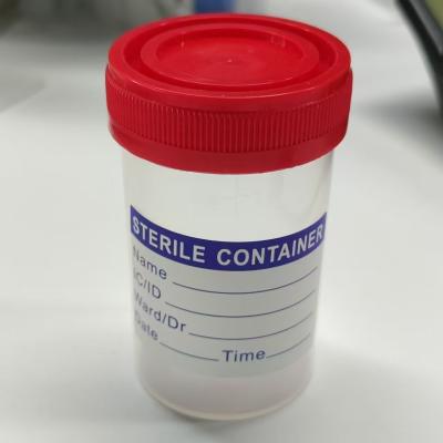 China Urine Container Sterile Sample Specimen Cup With Label 15ml-120ml Sterile Urine Container for sale