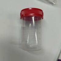 China Urine Container Sterile Sample Specimen Cup With Label 15ml-120ml Sterile Urine Container for sale