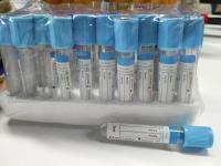 China PT Tube Laboratory Test Sodium Citrate Vacuum Blood Collection PT Tube With Blue Top for sale