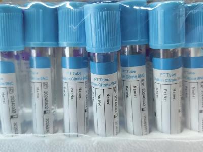 China PT Tube Laboratory Test Sodium Citrate Vacuum Blood Collection PT Tube With Blue Top for sale