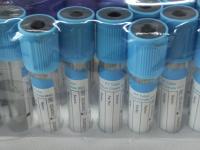 China PT Tube Laboratory Test Sodium Citrate Vacuum Blood Collection PT Tube With Blue Top for sale