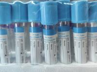 China Blue Top PT Tube Sodium Citrate Tube Vacuumed Blood Collection Tube for sale