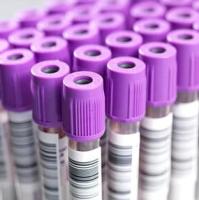 China 5ml EDTA K2 K3 Tube PET Or Glass Blood Collection Tube for sale